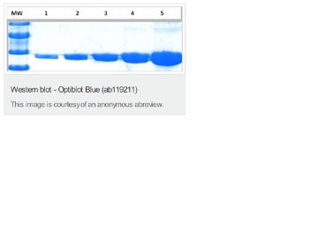 RSC - eStore. Products tagged with 'abcam'